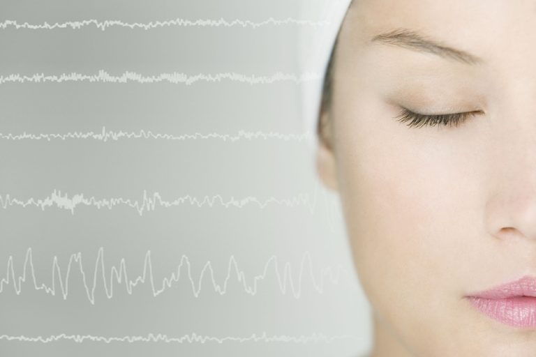 What Is a Sleep Study (Polysomnography)?