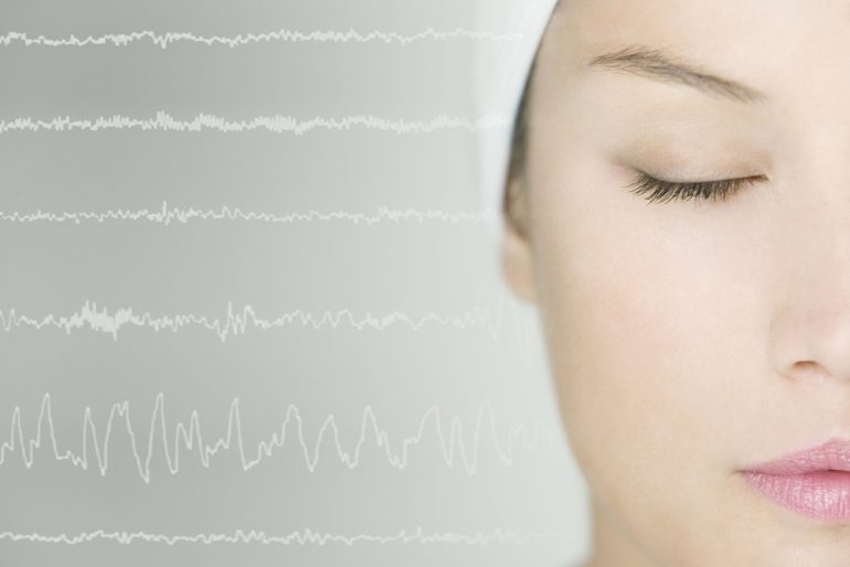 What Is a Sleep Study (Polysomnography)?